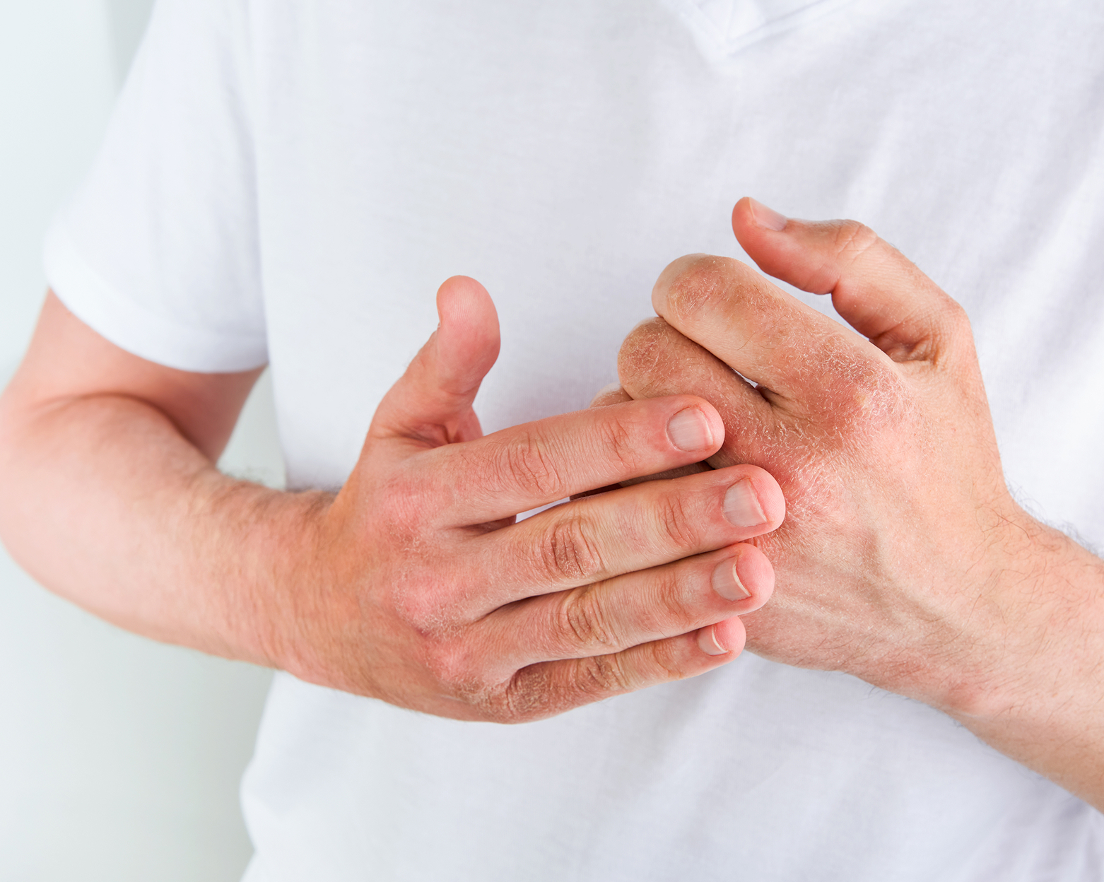 Skin Health & Inflammation - Immunity Health
